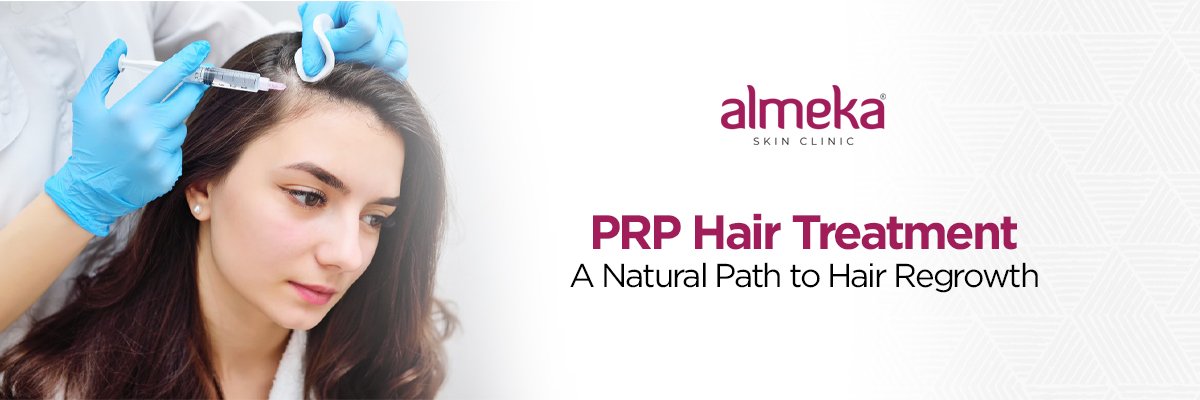 Bring Back Your Hair with PRP Hair Treatment - Almeka